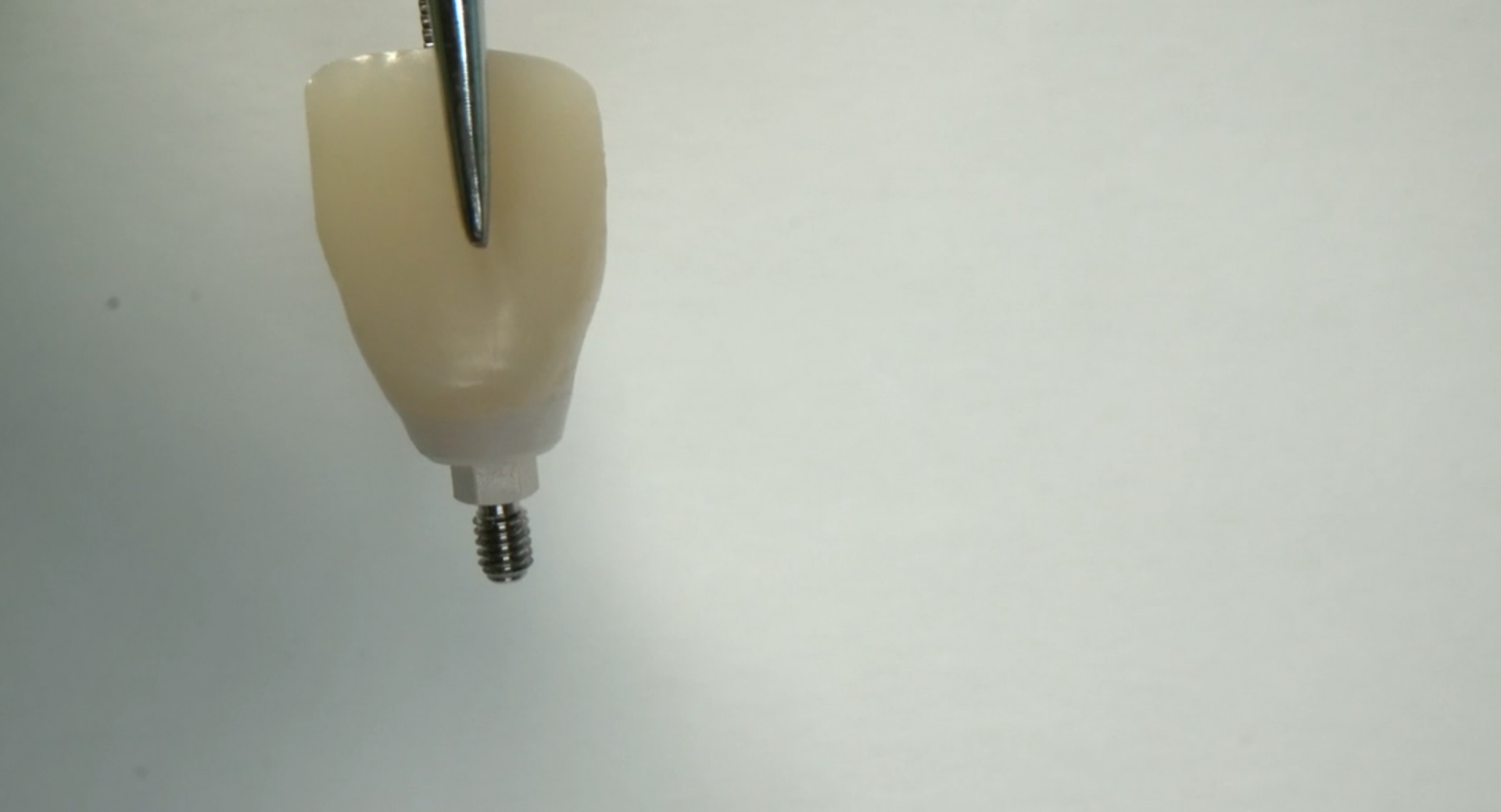 Transfer of the Custom Implant Provisional Contour Technique
