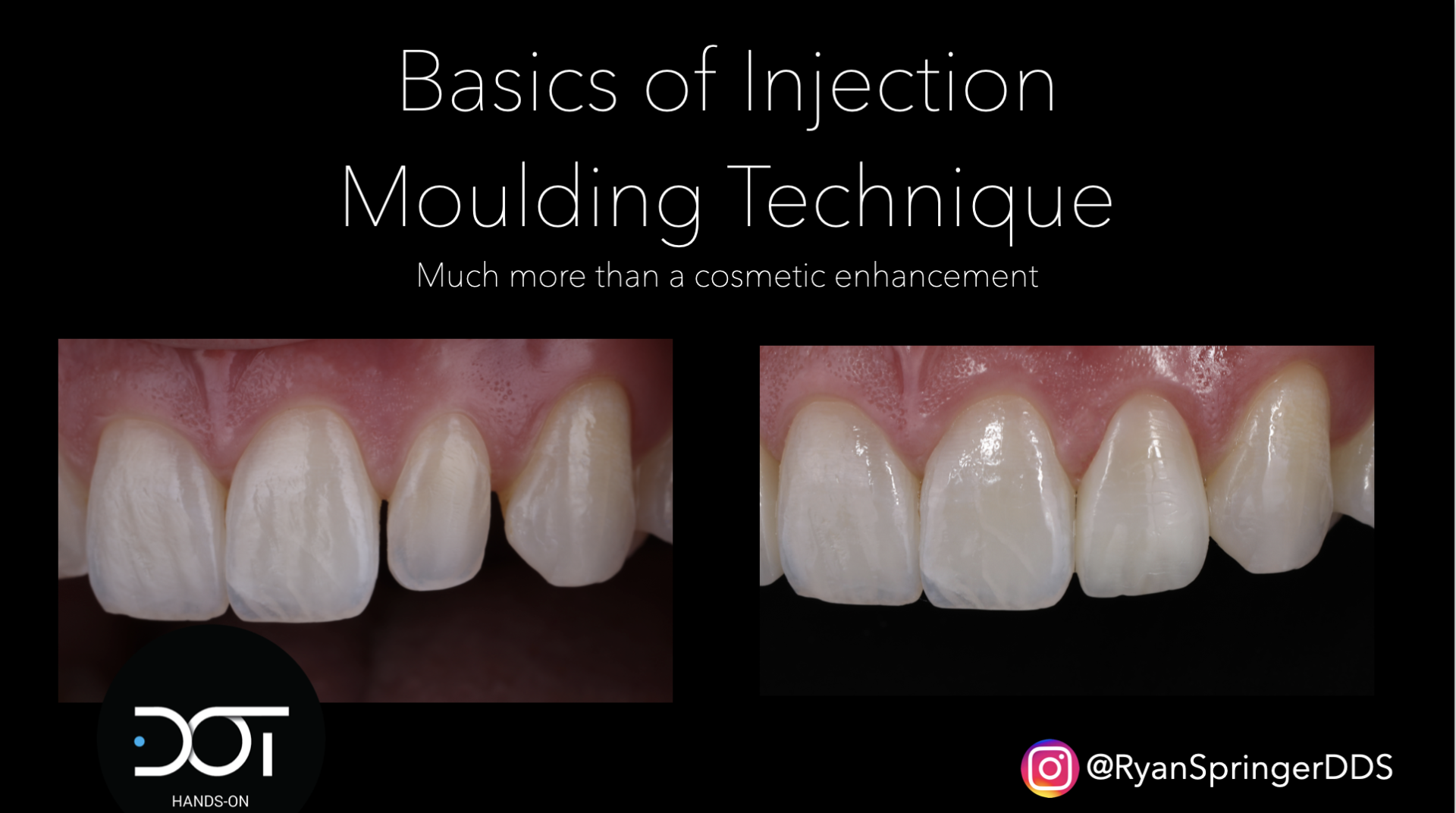 Injection Moulding Techniques; Predictability and Simplicity with ...